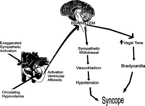 The Elusive Pathophysiology Of Neurally Mediated Syncope Circulation