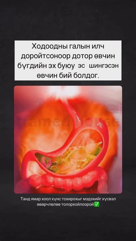 Mongolian Traditional Medicine ХИЙ ШАР БАДГАНы аль нь давамгай болох төрөлх өвөрчлөлөө мэдэх