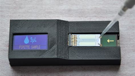 Microfluidics And Point Of Care Diagnostics Present And Future