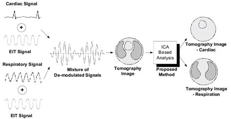Separation Of Cardiac And Respiration Signal Download Scientific Diagram