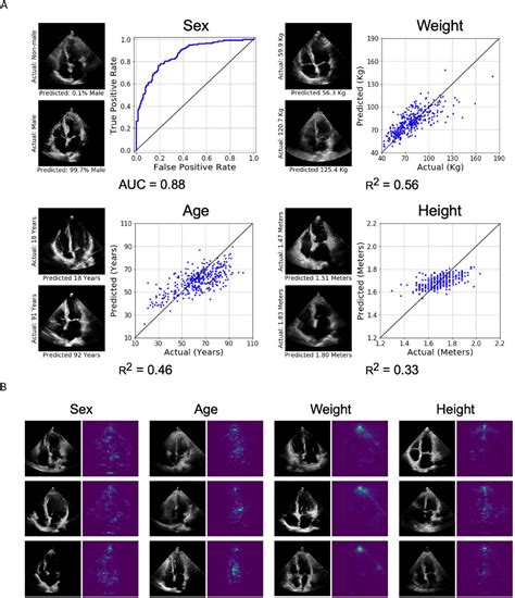 Echocardiogram View Classification By Deep Learning Model Download