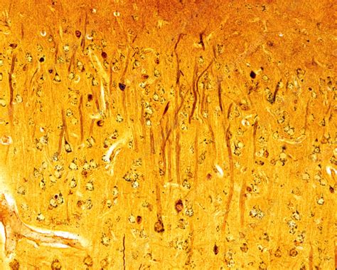 Cerebellar Cortex Light Micrograph Stock Image C059 7796 Science Photo Library