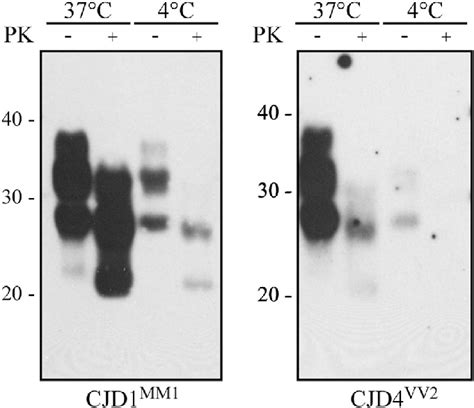 Pk Resistant And Sensitive Forms Of Disease Associated Prp Aggregates