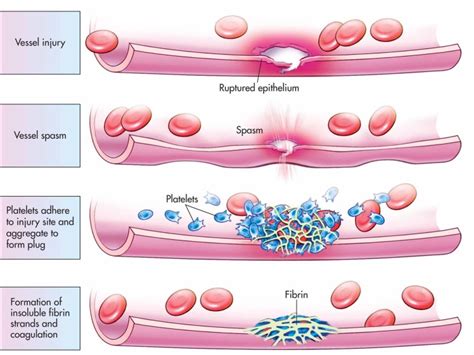 혈액검사수치 알아보기 혈소판수platelet 혈소판분포계수pdw 백혈구wbc 백혈구분획 호중구 호산구 호염기구 단핵구 림프구 네이버 블로그