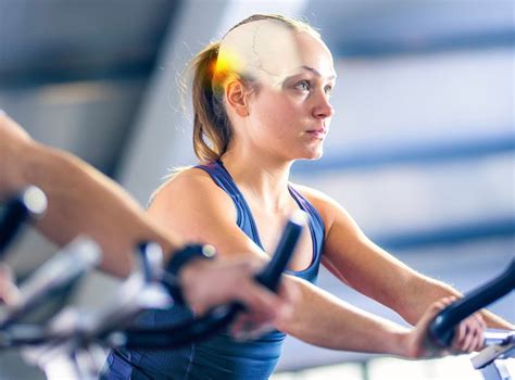 Peek Cmf Implants Sternal Fixation Devices