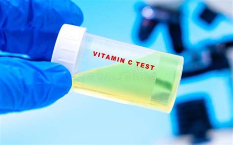 Assesses Levels Of Ascorbic Acid Vitamin C In Urine To Stock Image