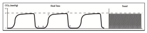 Waveform Capnography Flashcards Quizlet