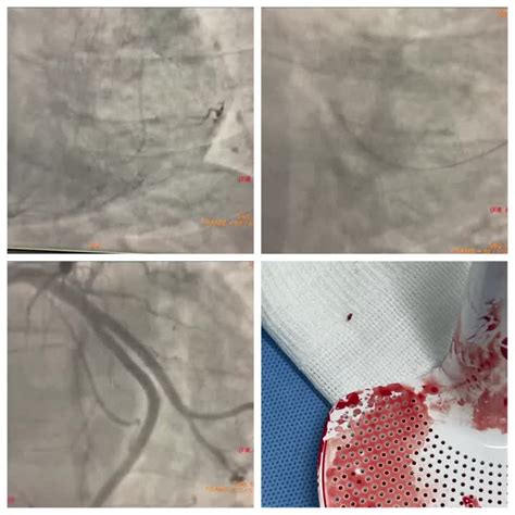 Augusto Daige On Linkedin Catrx