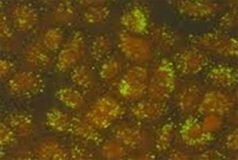 Chlamydia Trachomatis Giemsa Stain