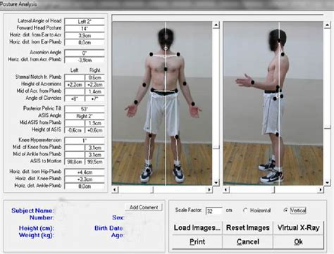 Reference Points Used In Posture Analysis Download Scientific Diagram