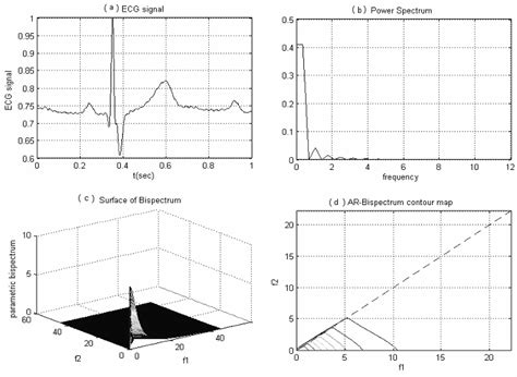 A Normal Ecg Pattern A With Its Power Spectrum B Bispectrum