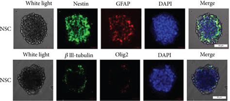Mir 34a 3p Suppressed Pdcd6 Expression In Differentiating Nscs