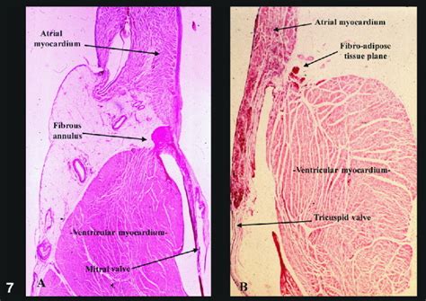 Interventricular Septum Histology