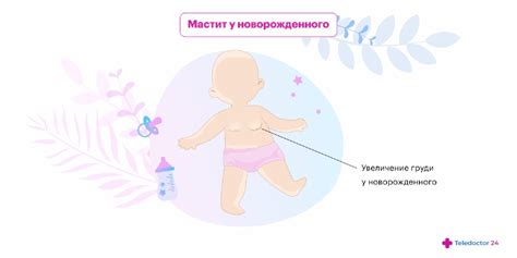 Мастит у новорожденных диагностика лечение