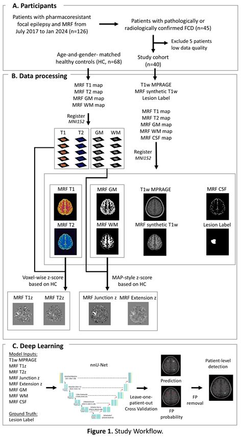 Whole Brain Focal Cortical Dysplasia Detection Using Mr Fingerprinting With Deep Learning