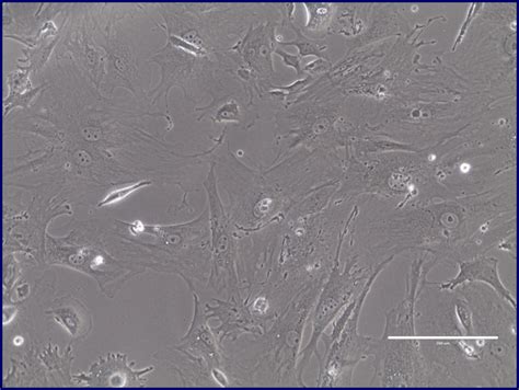 Primary Mouse Embryonic Fibroblast Cells Bioinnovatise