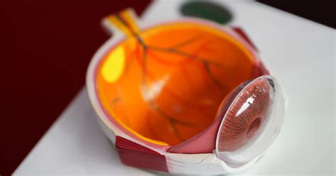 Delayed Diagnosis Of Congenital Optic Disc Abnormalities May Worsen Visual Prognosis