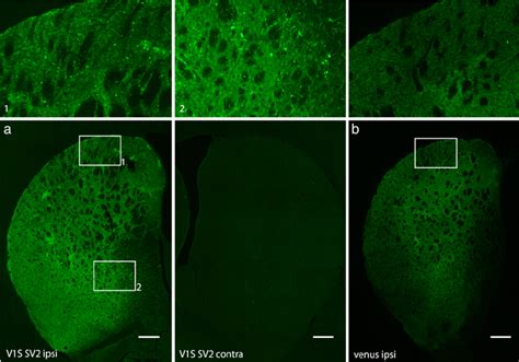 Detection Of Alpha Synuclein Oligomers In The Striatum The Neuronal Download Scientific