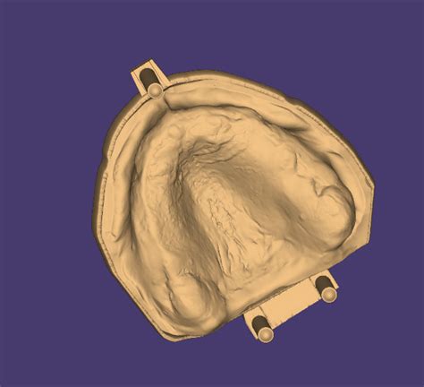 🦷 Dentura Total Removible Superior Dentura Flexi Parcial Inferior Total 11 Archivos Stl