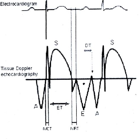 Tissue Doppler Imaging Medcrave Online