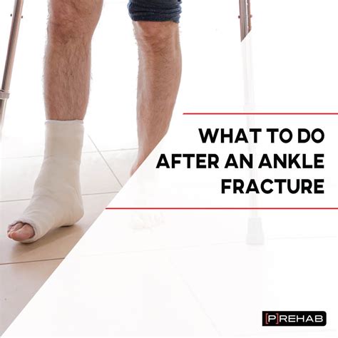 What To Do After An Ankle Fracture With Exercise P Rehab