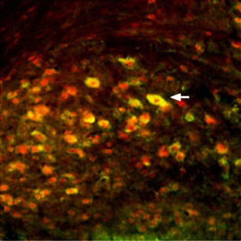 Nmda Receptor Agonists And Antagonists Alomone Labs
