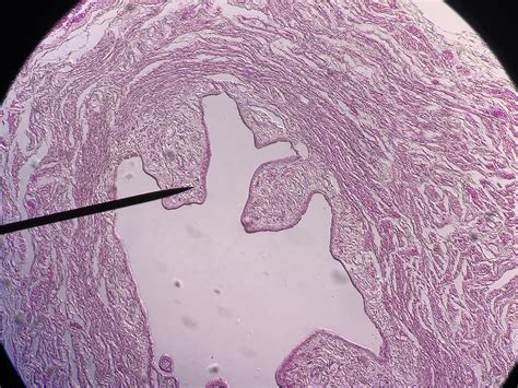 Uterine Tube Histology