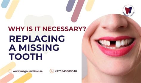 Replacing A Missing Tooth Reasons Why Is It Necessary