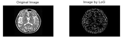 Log Edge Detection Results Download Scientific Diagram