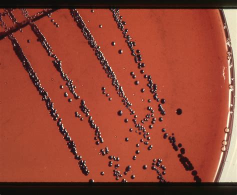 Corynebacterium Diphtheriae Colony Morphology