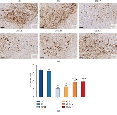 Figure 1 From Curcumin Regulates Gut Microbiota And Exerts A Neuroprotective Effect In The Mptp