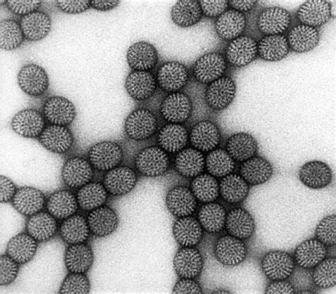 Rotavirus Description Characteristics Infection Symptoms