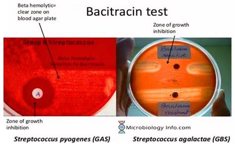 Streptococcus Pyogenes Diagram