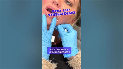 Pdo Threads For Lips Great For Lip Definition Youtube