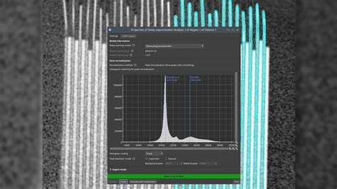 Deep Segmentation Add On Modules Products