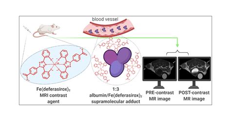 Gadolinium Contrast Agents