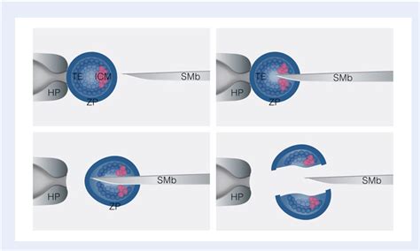 Figure 1 From Potential Of Human Twin Embryos Generated By Embryo