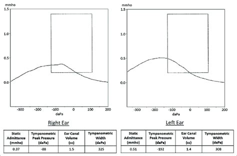 Tympanometric Results Of A Patient Download Scientific Diagram