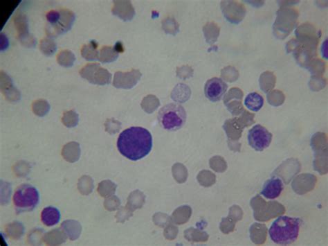 Flickriver Photoset Eritropoese By Dione1986