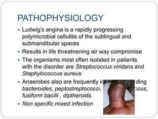 Ludwigs Angina Pptx