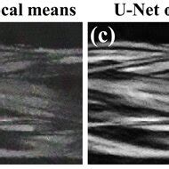 The Noisy Input A The Denoised Image Using The Non Local Means