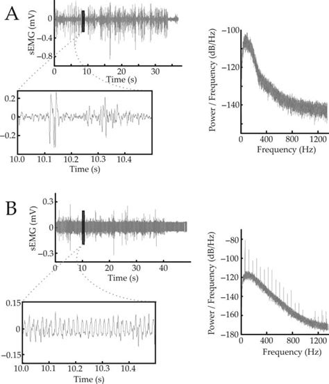 Surface Electromyography Semg Recordings Illustrating High