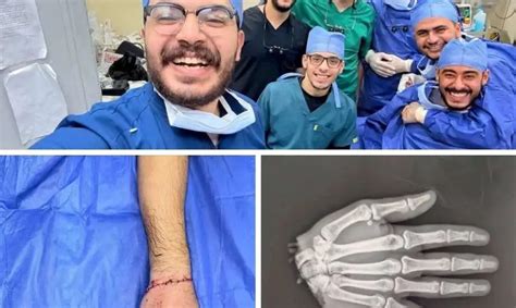 After Grueling 12 Hour Surgery Azhar Doctors Successfully Reattach