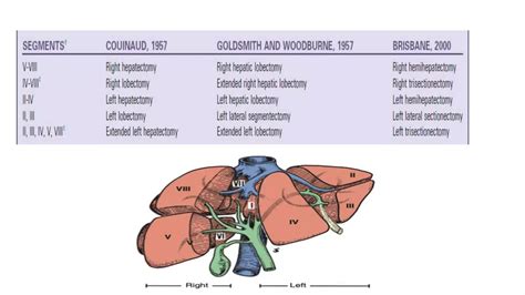 Cholangiocarcinoma Pptx Cholangiocarcinoma Pptx