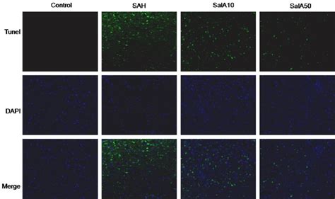 Representative Confocal Images Show Tunel Staining Of Cerebral Cortex Download Scientific