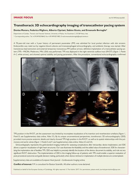 Pdf Transthoracic 3d Echocardiography Imaging Of Transcatheter Pacing
