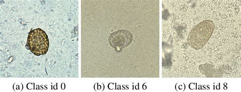 Figure 1 From Parasitic Egg Detection And Classification With Transformer Based Architectures