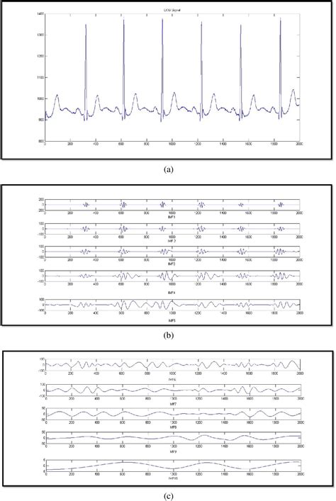 Figure 3 4 From Denoising And Artifacts Removal In Ecg Signals Semantic Scholar