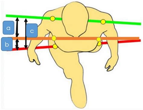 Spinal Horizontal Plane Relative Motion Measurement Image Referred To