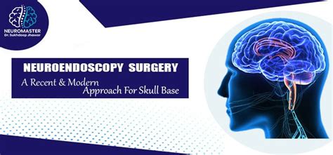 Neuroendoscopy Surgery Lets Catch On Advanced Skull Base Surgery